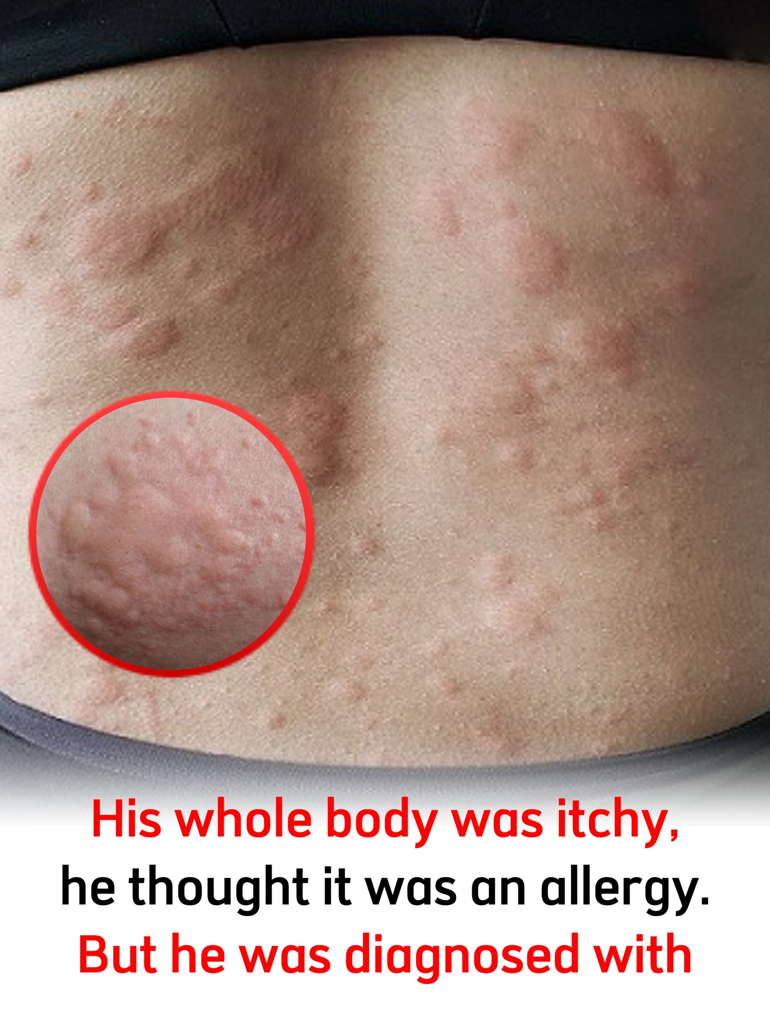 Believing His Sudden Full-Body Itching Was Just a Simple Allergy, He ...