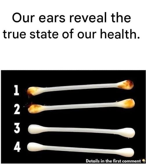 Our ears can reveal hidden health clues through earwax color, texture ...