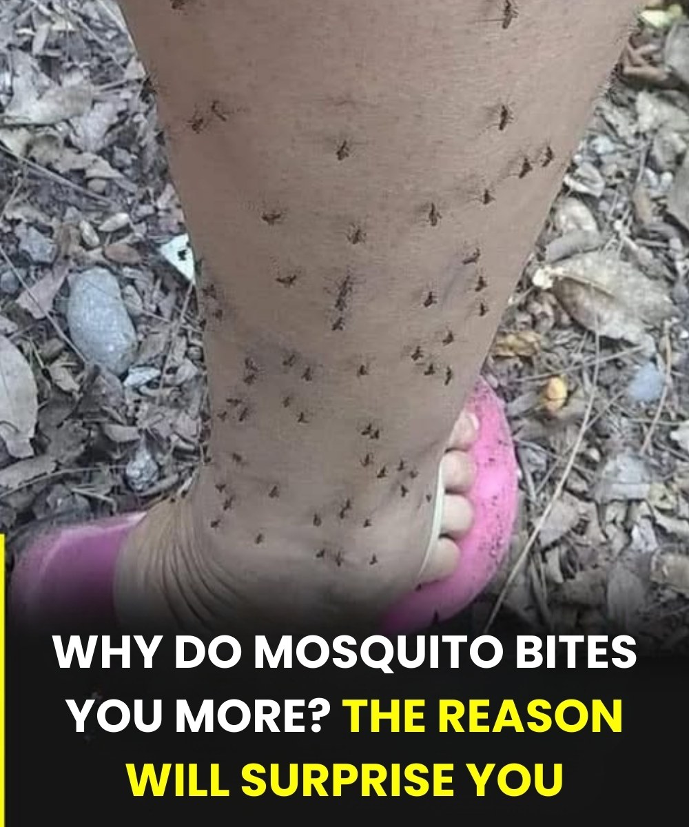 Why mosquitoes always seem to choose you over everyone else, revealing ...